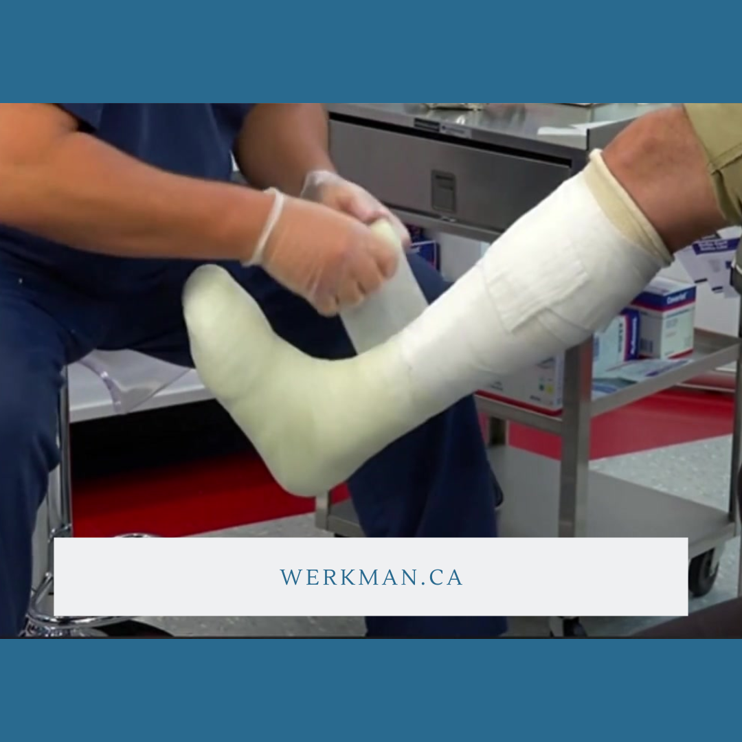 Total Contact Casting & Alternatives - Werkman, Boven & Associates