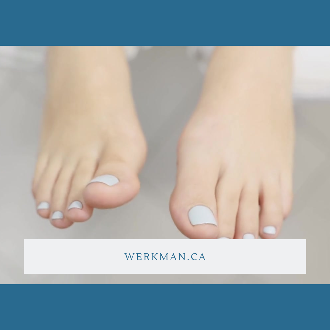 A Guide to Ingrown Toenails - Werkman, Boven & Associates
